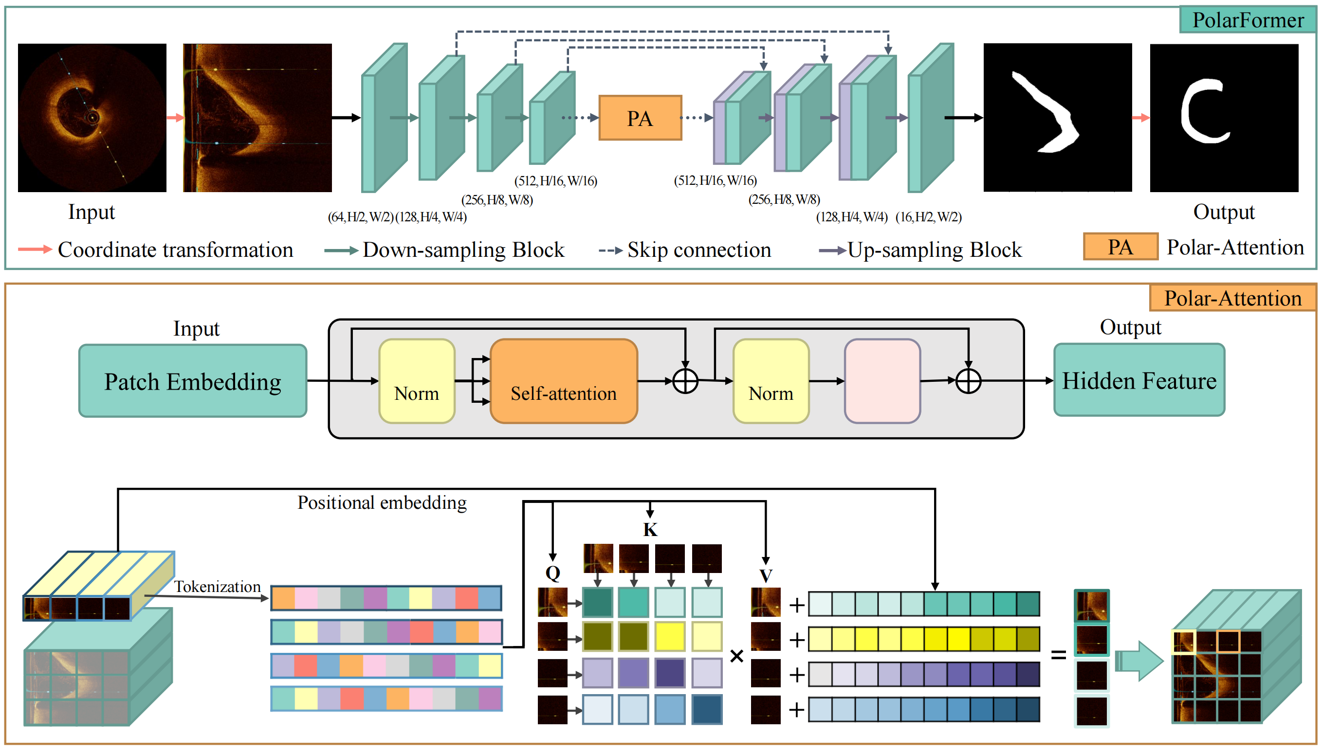 Ivoct Lesion Segmentation Detection Project