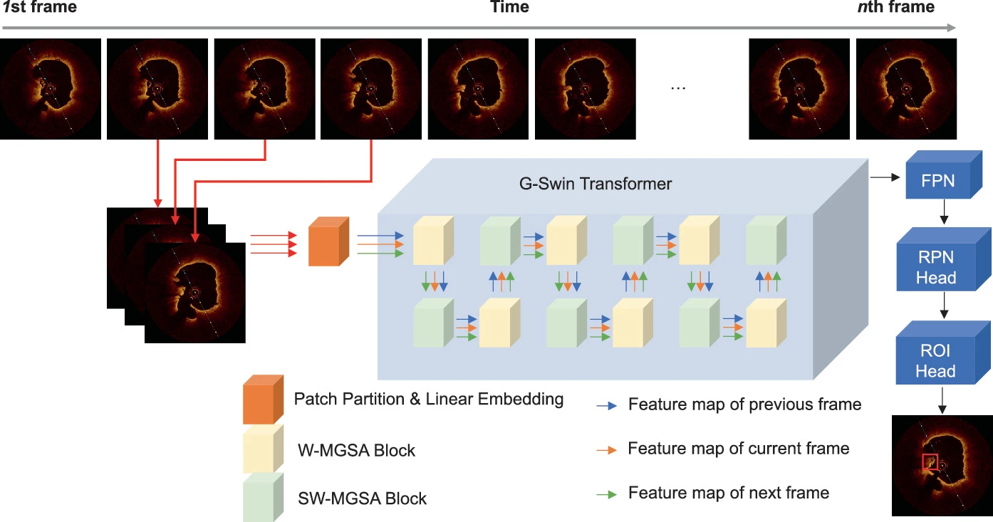 IVOCT-Lesion-Segmentation-Detection-Project